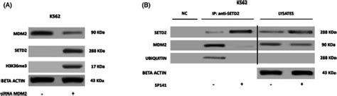 Setd2 Loss Of Function Is A Recurrent Event In Advanced‐phase Chronic