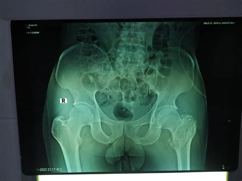 Radiology Bone Collection Opensea Radiology Bone Collection Opensea