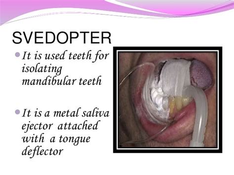 Fluid Control And Soft Tissue Management In Fpd