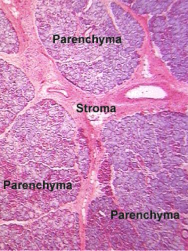Neoplasia 1 Flashcards Quizlet