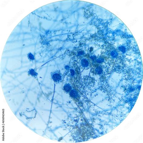 Aspergillus Spp Under Light Microscope Stain With Lactophenol Cotton