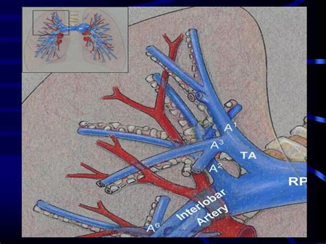 Pulmonary Artery Anatomy And Pulmonary Embolism Pdf