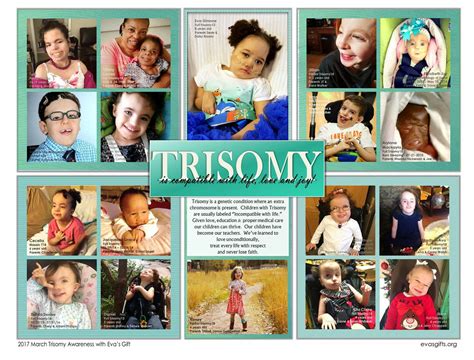 Brandons Mosaic Brandons Mosaic Trisomy 18 Journey