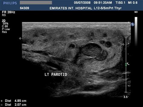 A Gallery Of High Resolution Ultrasound Color Doppler And 3d Images