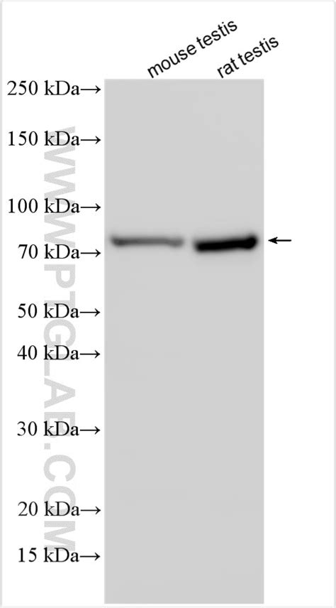 Cd2ap Antibody 32089 1 Ap Proteintech