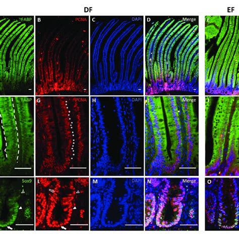 Villus And Crypt Cell Sub Type Counts Are Affected By The Timing Of