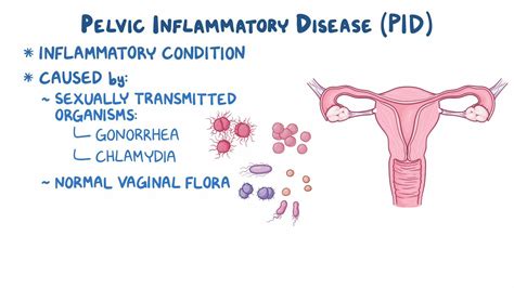 Pelvic Inflammatory Disease In Men