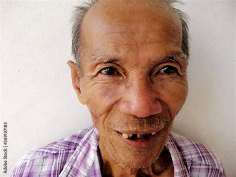 Wrinkled Face