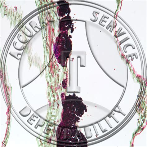 Ustilago Avenae Prepared Microscope Slide