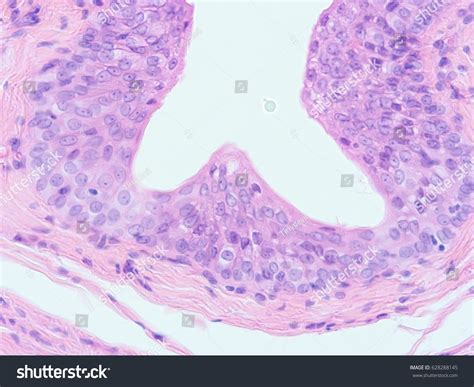 Transitional Epithelium Histology