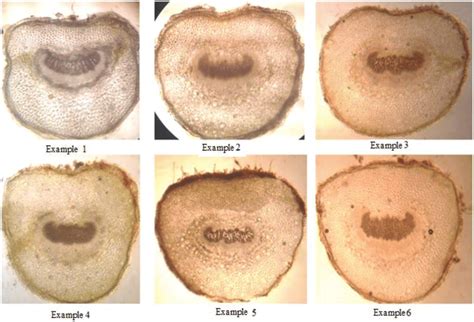 Microphotographs Of An Anatomic Structure Of A Cross Section Of The