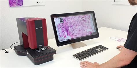 What Is Rohs App Digital Microscope