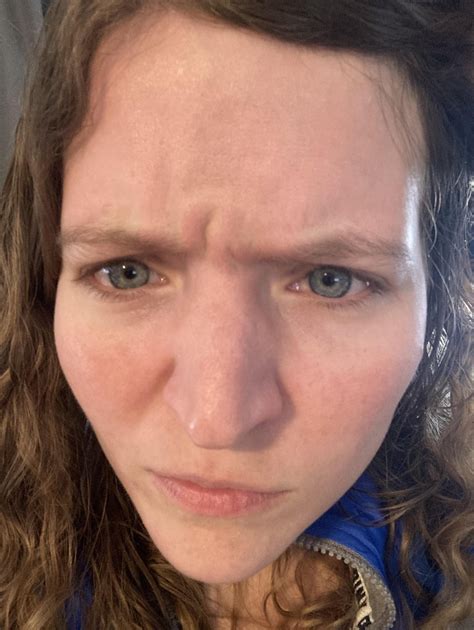 I Got Botox On March 7th And Its Almost All Worn Off Has Anyone Else Had This Happen R