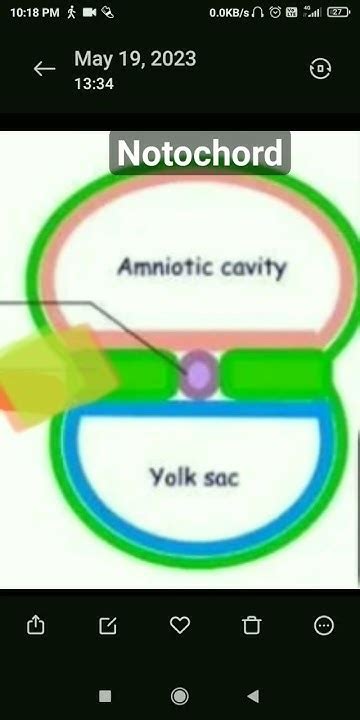 Notochord Notocord Notochordal Process Embryonic Inducers
