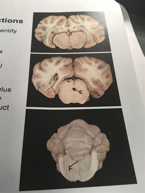 Biopsych 3 Diagram Quizlet