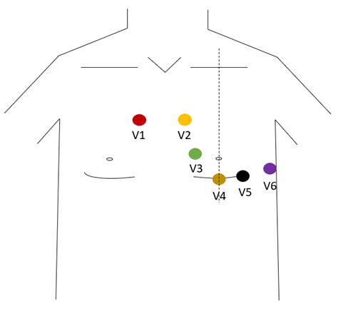Ecg Réalisation — Uness Cardiologie