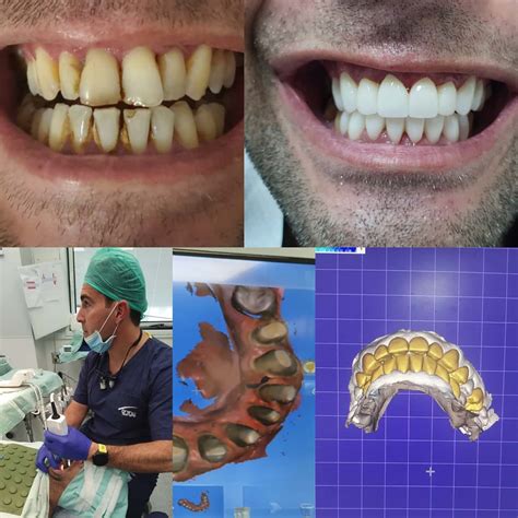 מרפאות דר ערן שומר להשתלות שיניים ואסתטיקה מגשימים חלומות לאנשים מרפאת שיניים דר שומר ערן