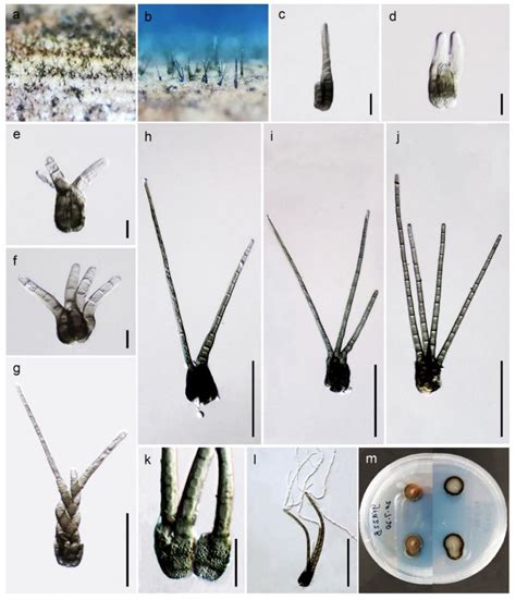 Tetraploa Dashaoensis Faces Of Fungi