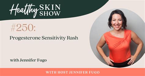 250 Progesterone Sensitivity Rash