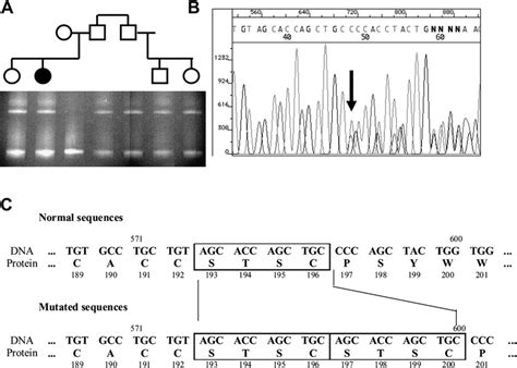 Molecular Diagnostics Of The Mutation In Exon 6 Of The Sdhb Gene A Download Scientific