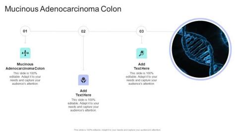 Mucinous Adenocarcinoma Colon In Ppt Powerpoint Presentation Slide Templates Cpp Ppt Presentation