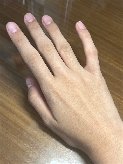 손 예뻐지는법 지식in