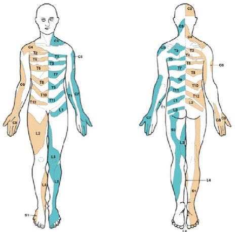 C6 Dermatome Tingling Understanding Cervical Radiculopathy Symptoms And Treatment