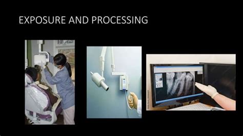 Dental Radiology Bitewing Radiography Copy Pptx