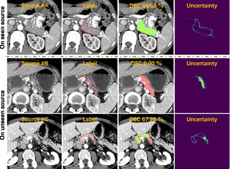 figure 1 from generalizable pancreas segmentation via a dual self