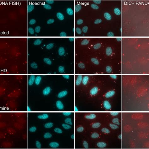 The Cytoplasmic Puncta Forming After Transient Transfection Are