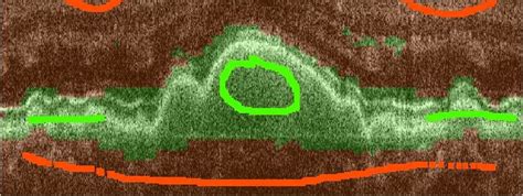 Influence Of Multi Resolution Hierarchy On SVM Segmentation Top Image Download Scientific