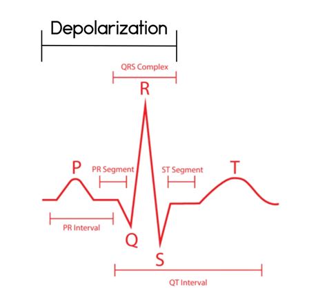 Ventricular Depolarization Causes Of Qt Prolongation Medicine