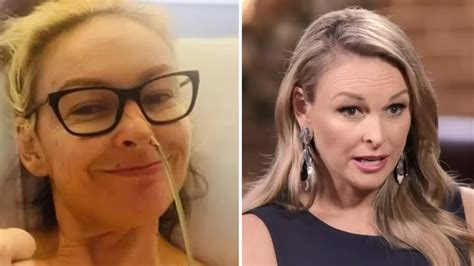 Concerning Symptoms Mafs Expert Mel Schilling Noticed Before Being