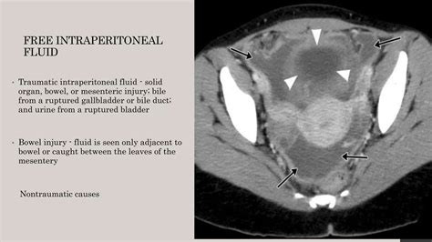 Bowel And Mesenteric Injury Pptx