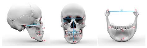 Anatomically Correct Skull At Kenneth Neilson Blog