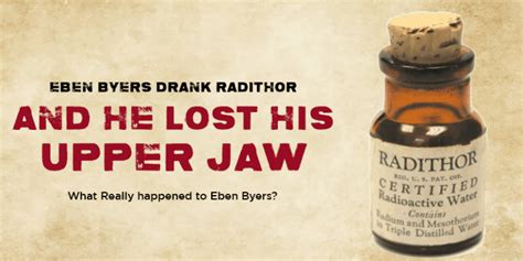Eben Byers — The Disturbing Story Of The Man Who Lost A Jaw Morbid