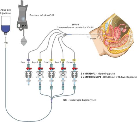 Three Dimensional Urethral Profilometry A Global Urethral Pressure