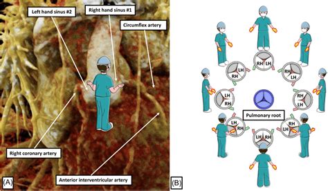 If The Observer Stands In The Nonadjacent Sinus Of The Aortic Root And Download Scientific
