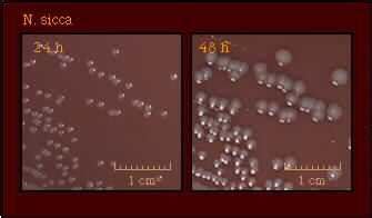 Neisseria Sicca Gonorrhea Std Information From Cdc