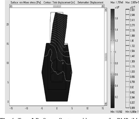 Figure 1 From Design Optimization Of Dental Implants Using Finite Element Analysis For Injecting