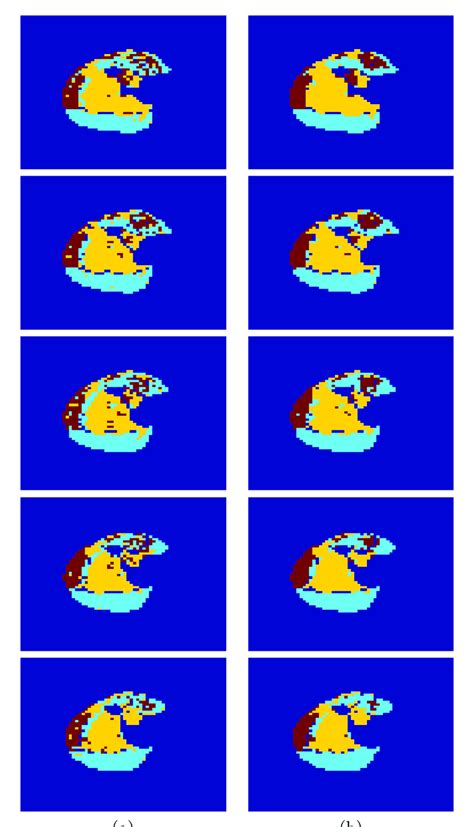 10 Axial Slices Of The Supervised Svm Classification Of Tensors In
