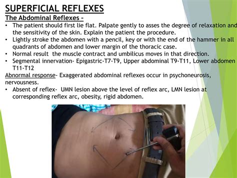 Part 5 Examination Of Reflex Pptx