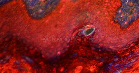 Scar Tissue Stock Footage Video Of Skin Cells Digestion 204808242