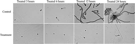 Microscopic Observation Of B Cinerea Spore Germination And Penetration Download Scientific