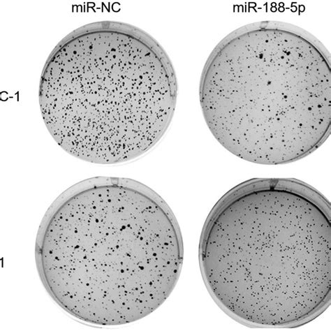 Soft Agar Assay Was Performed To Determine The Anchorage Independent