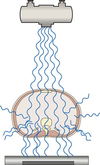 X Ray Interactions With Matter Radiology Key
