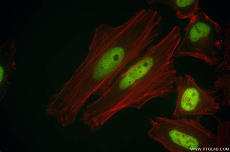Smarca2 Specific Antibody 85018 4 Rr Proteintech