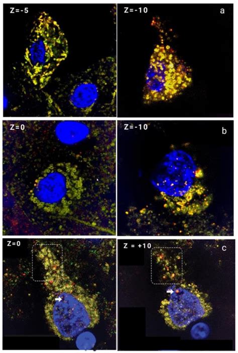 Complete Z Stack Imaging Reveals Mitochondria Clustered At The Far
