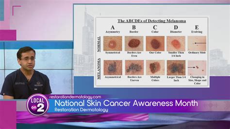 Take The Steps To Prevent Skin Cancer Wkrn News 2