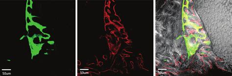 Osteogenesis Assessment Via Laser Scanning Confocal Microscopy Revealed